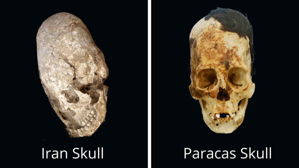 Grave of Ancient Elongated Skulls Discovered in Iran